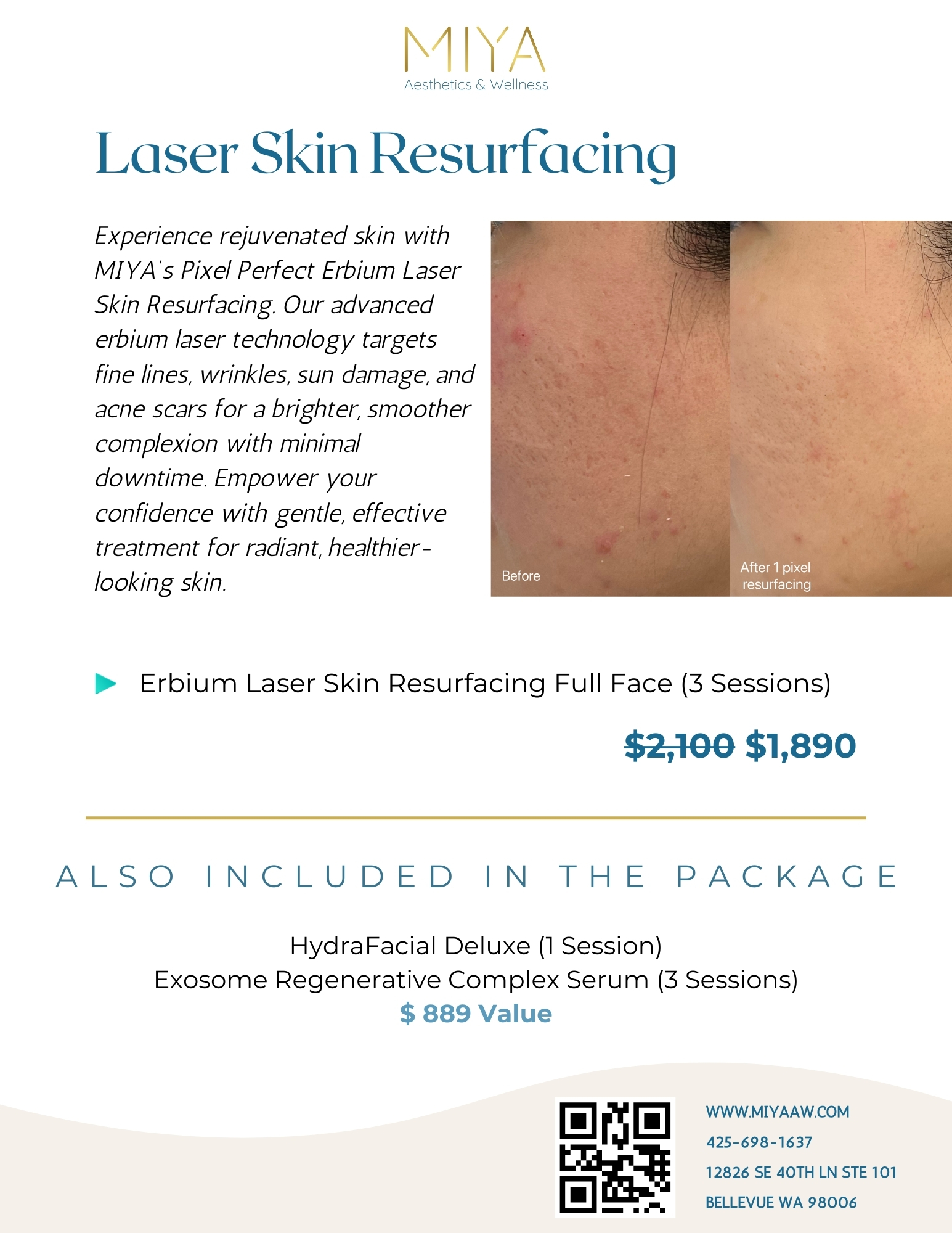 Pixel Erbium laser Skin Resurfacing - MIYA Aesthetics & Wellness