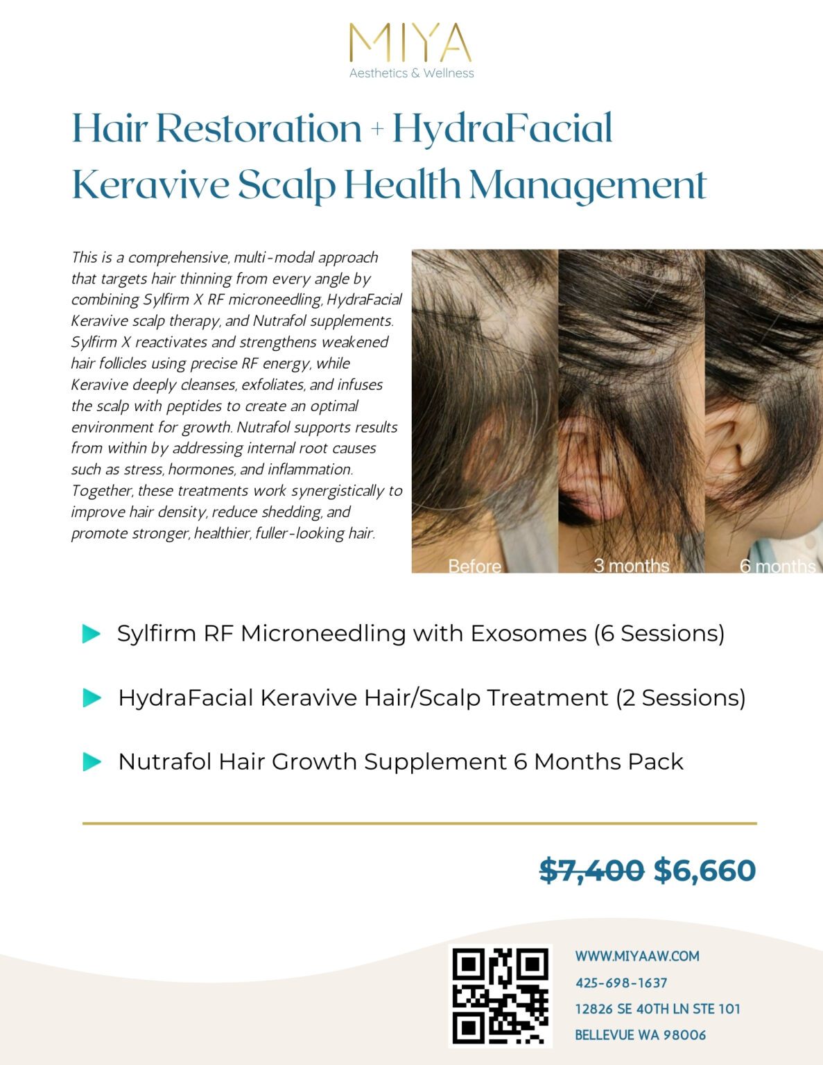 Hair Restoration - MIYA Aesthetics & Wellness